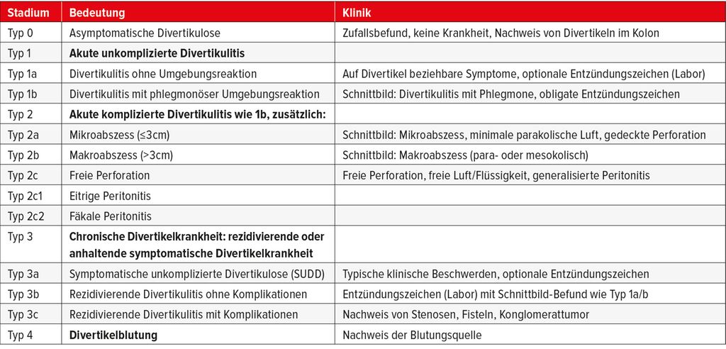 Behandlung der Sigmadivertikulitis – aktualisierte Leitlinien - Gastroenterologie - Universimed ...